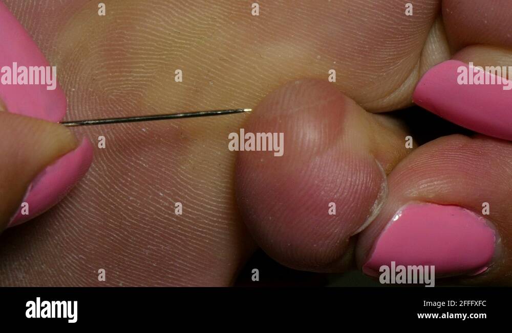 Puncturing Stock Videos & Footage - HD and 4K Video Clips - Alamy