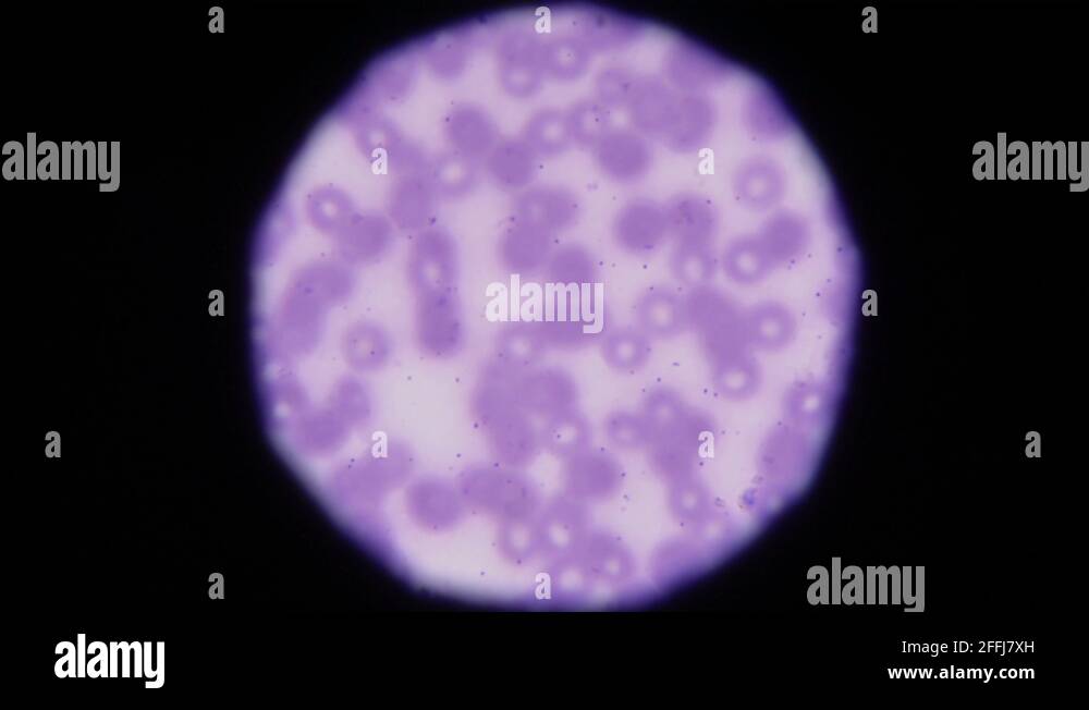 Blood smear red blood cells Stock Videos & Footage - HD and 4K Video ...
