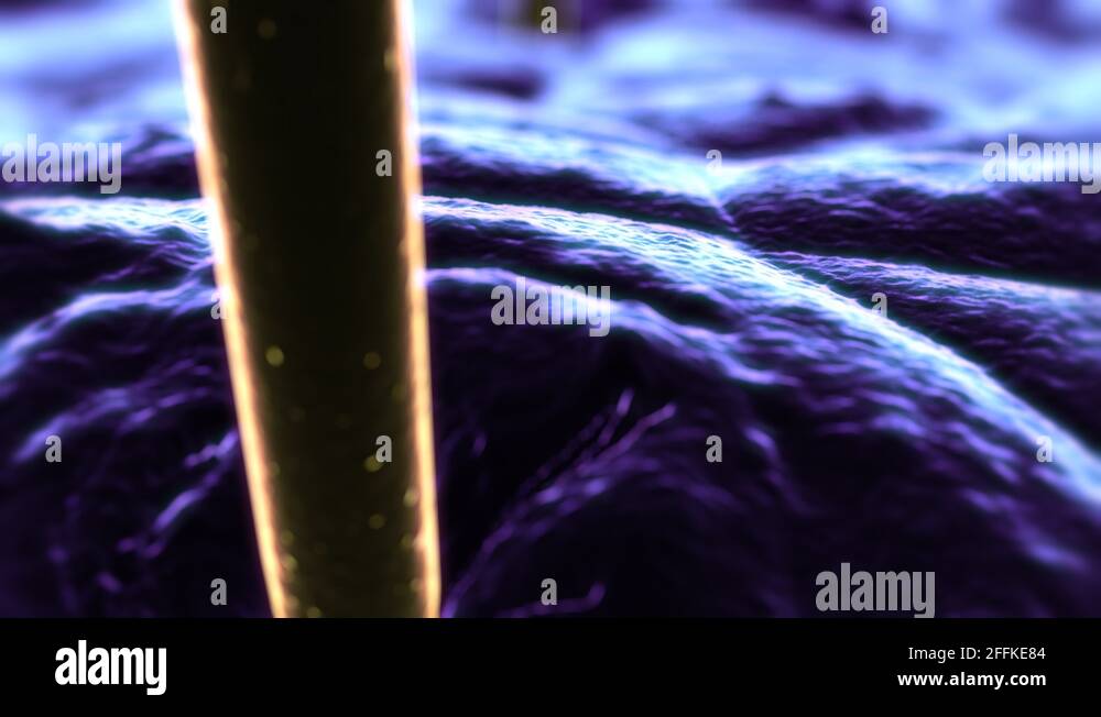 SEM Scanning Electron Microscope photo of single human hair and skin ...