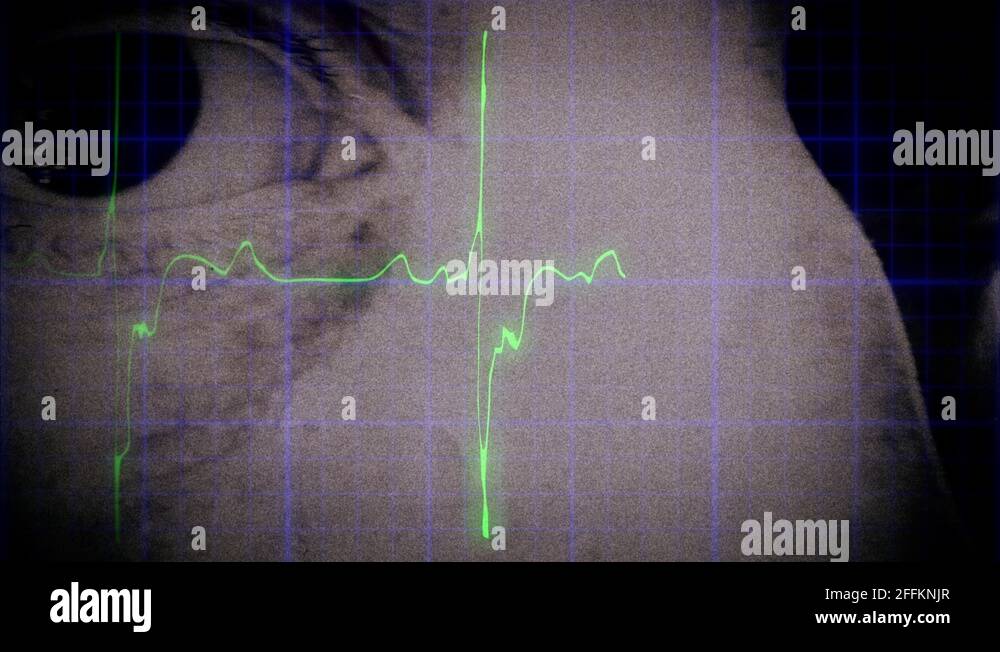 Eye chart and heart Stock Videos & Footage - HD and 4K Video Clips - Alamy