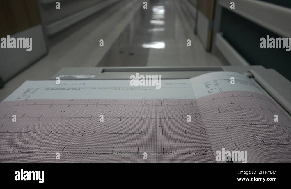 Ekg paper Stock Videos & Footage - HD and 4K Video Clips - Alamy
