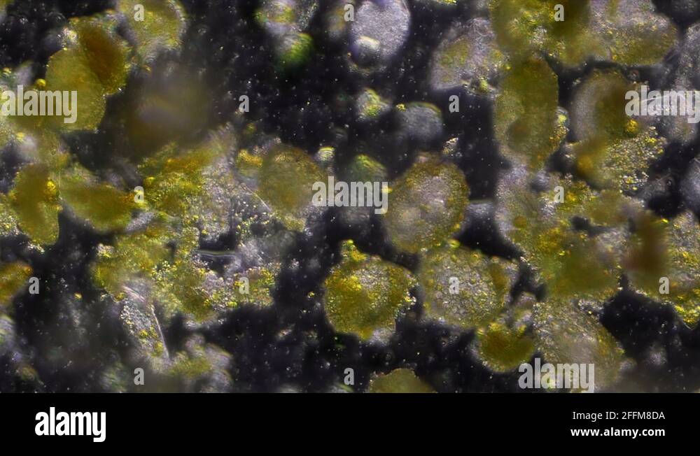 Allergy to grain pollen Stock Videos & Footage - HD and 4K Video Clips ...