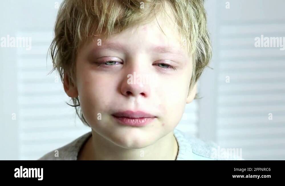 Kid crying ears Stock Videos & Footage - HD and 4K Video Clips - Alamy