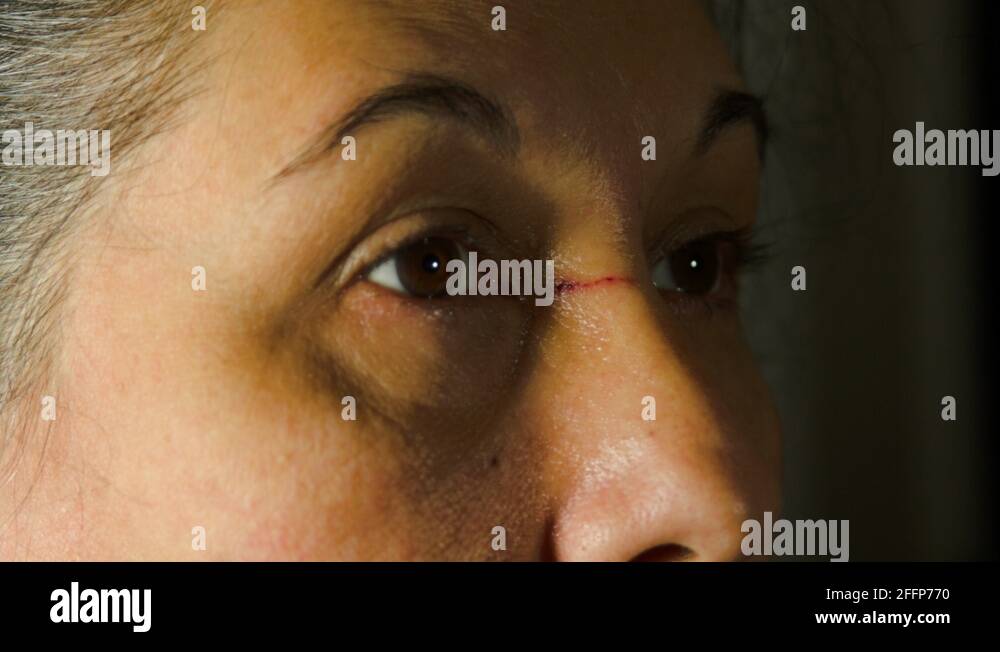 Cat scratch blood Stock Videos & Footage - HD and 4K Video Clips - Alamy