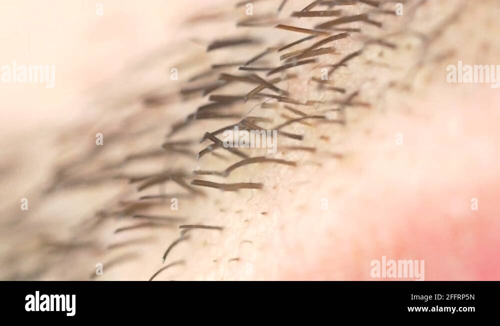 Hair root cell Stock Videos & Footage - HD and 4K Video Clips - Alamy