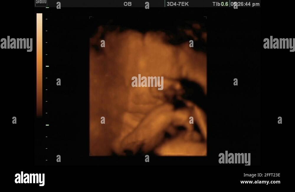 30 weeks pregnant Stock Videos & Footage - HD and 4K Video Clips - Alamy