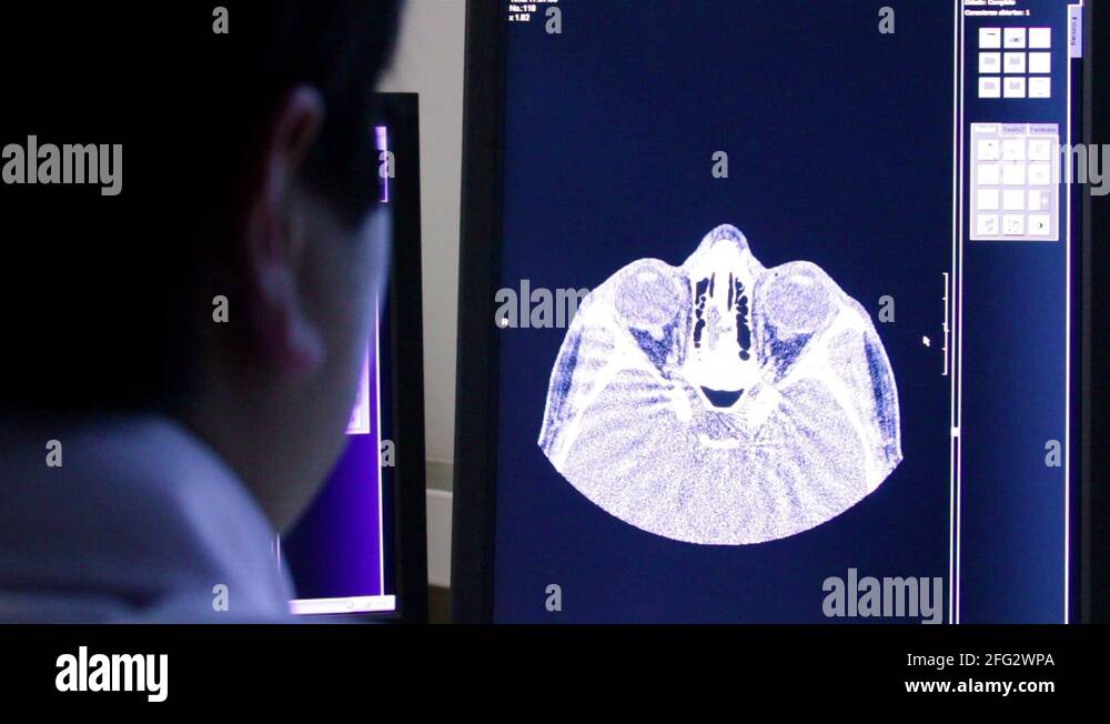 Brain death scan Stock Videos & Footage - HD and 4K Video Clips - Alamy