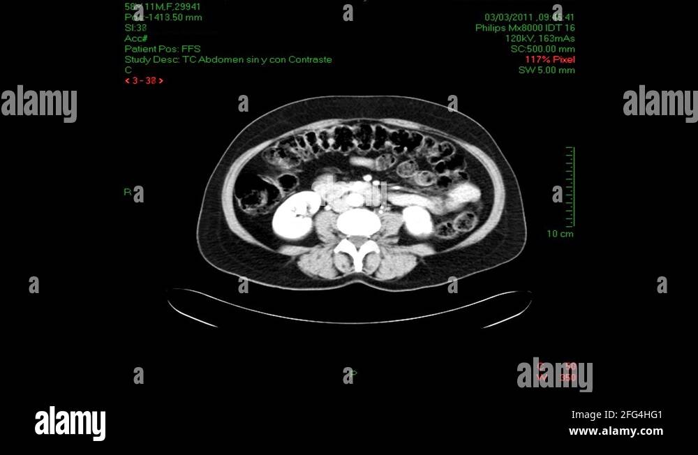 Abdomen mri Stock Videos & Footage - HD and 4K Video Clips - Alamy