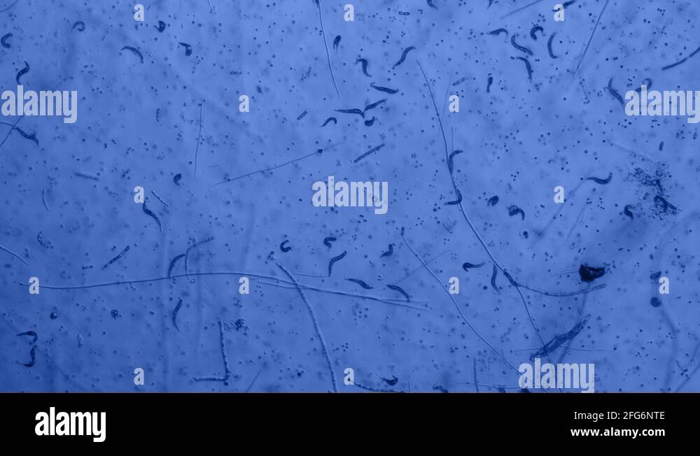 Nematode Worms Seen on Microscope at 40x Blue Filter Stock Video ...