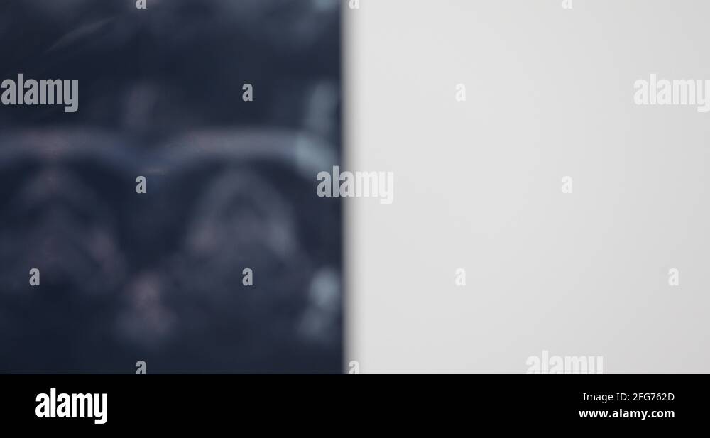 Panoramic scan radiography Stock Videos & Footage - HD and 4K Video ...