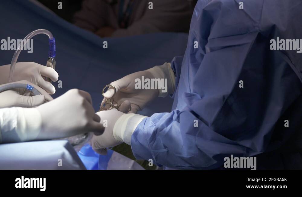 Lung surgery Stock Videos & Footage - HD and 4K Video Clips - Alamy
