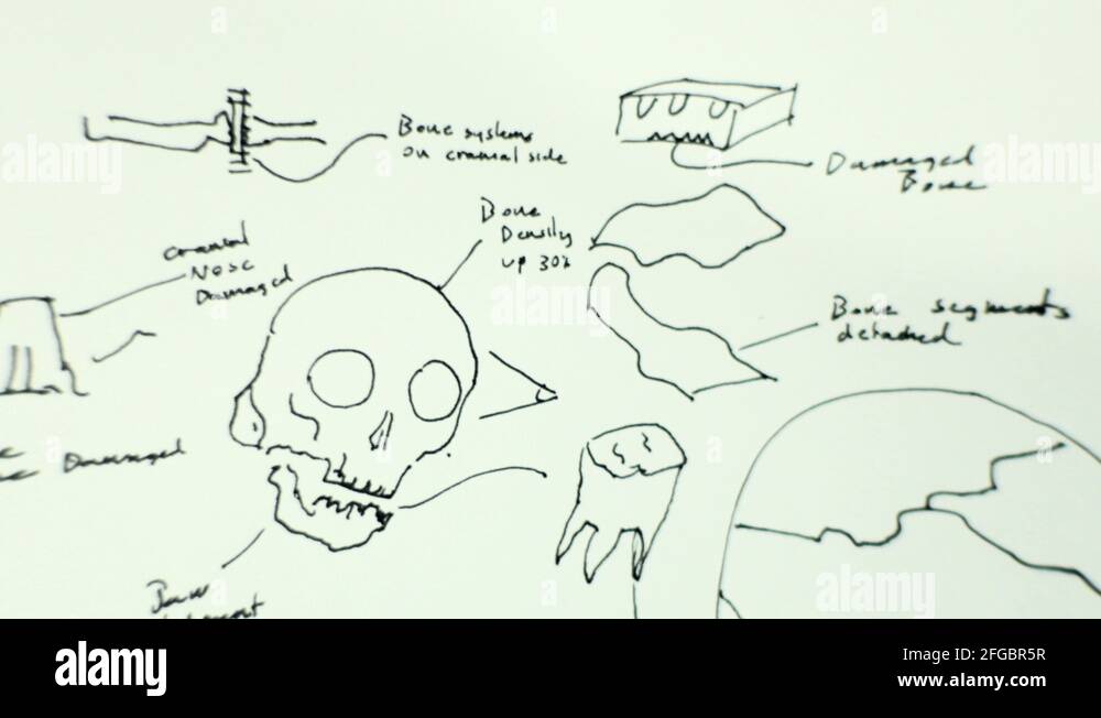 Medical anatomy drawings Stock Videos & Footage - HD and 4K Video Clips ...