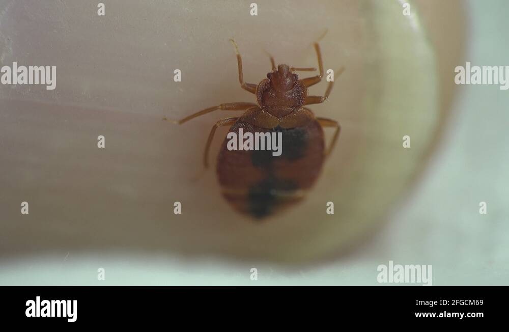 Bedbug insect parasite on human skin, macro Stock Video Footage - Alamy