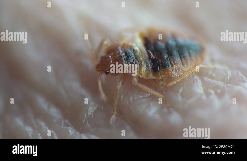 Bedbug insect parasite on human skin, macro Stock Video Footage - Alamy