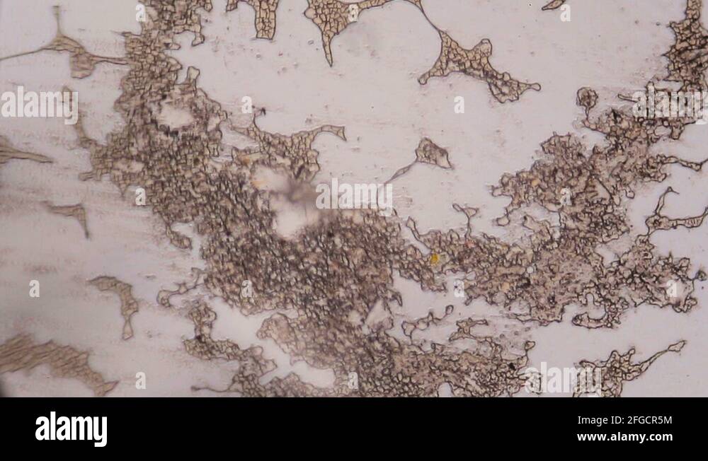 Congealed blood cells under the microscope Stock Video Footage - Alamy