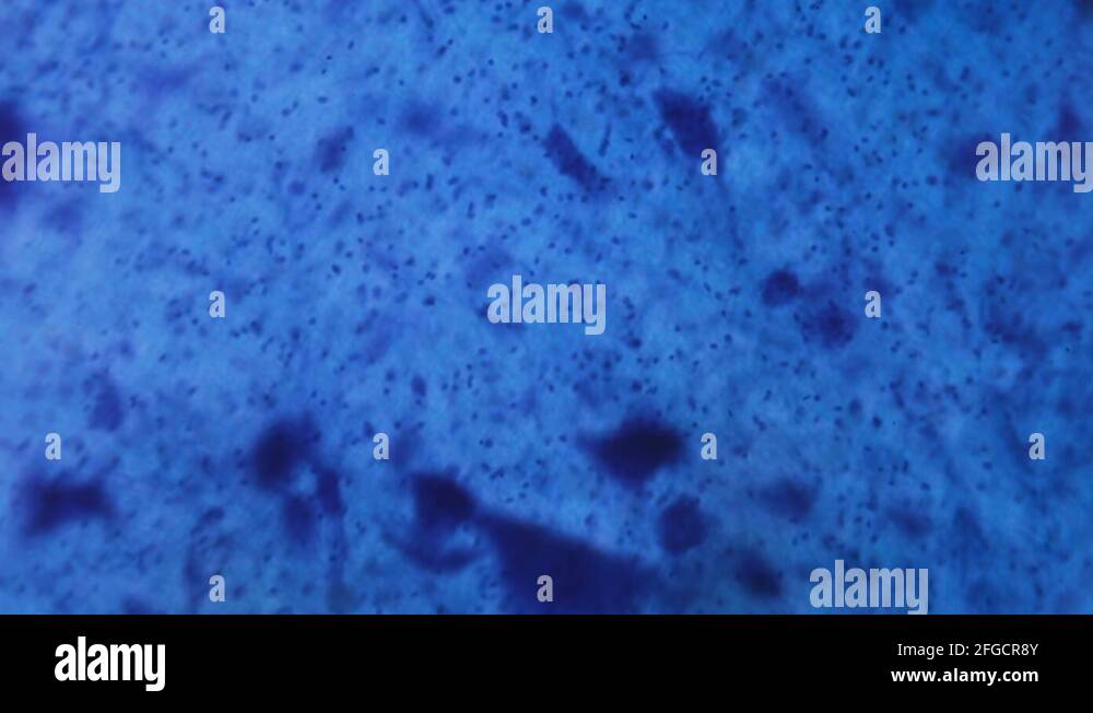 Nerve cell under the microscope - Abstract blue dots on white ...