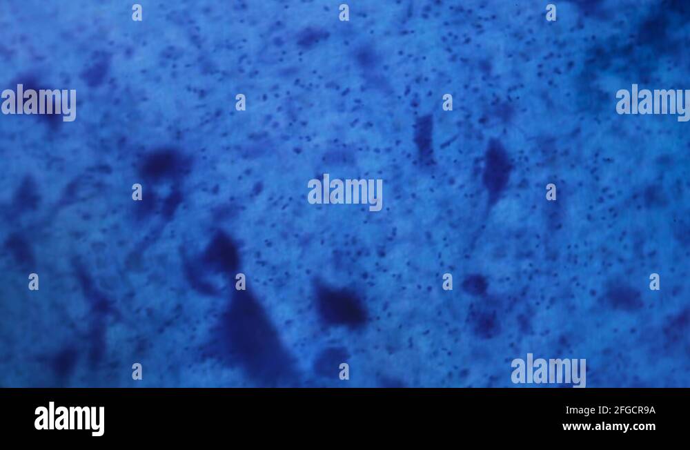 Nerve cell under the microscope - Abstract blue dots on white ...