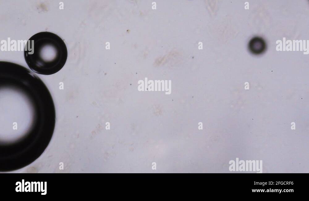 Water bubbles under the microscope Stock Video Footage - Alamy