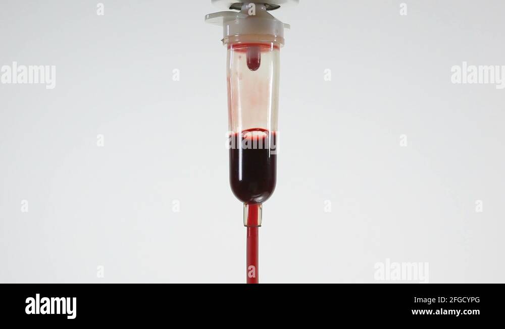 Blood transfusion operation Stock Videos & Footage - HD and 4K Video ...