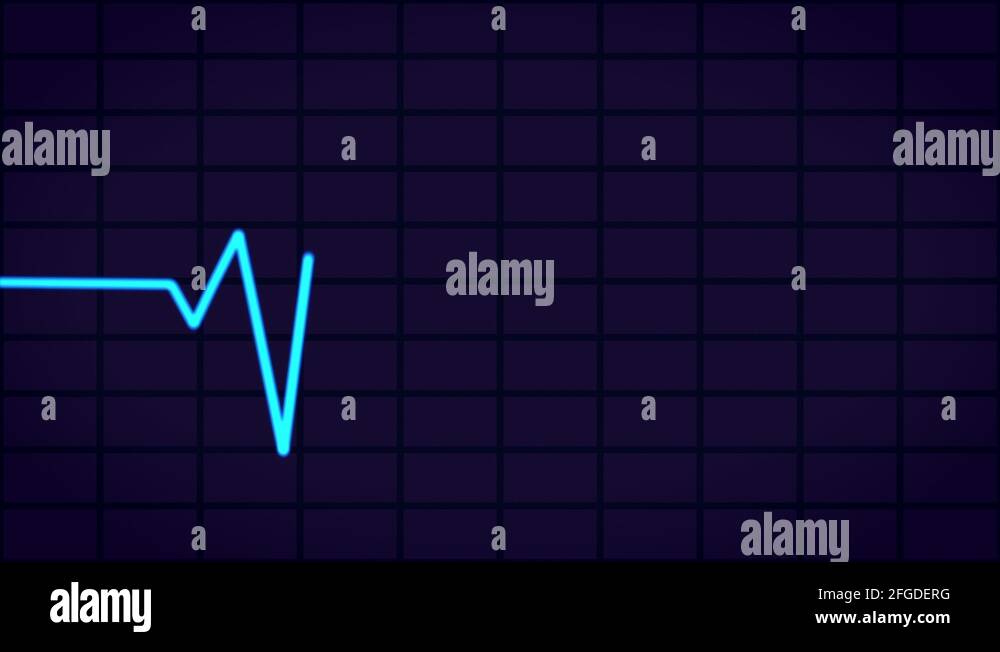 electrocardiogram (EKG or ECG) blue loop Stock Video Footage - Alamy