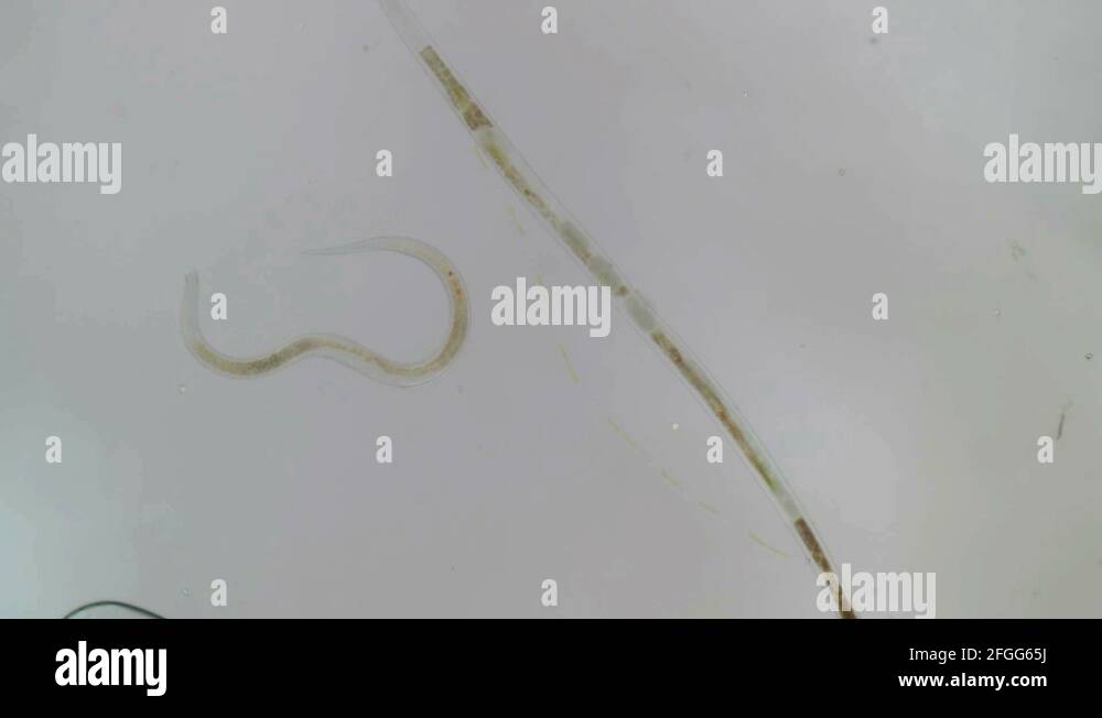 Nematode eggs Stock Videos & Footage - HD and 4K Video Clips - Alamy