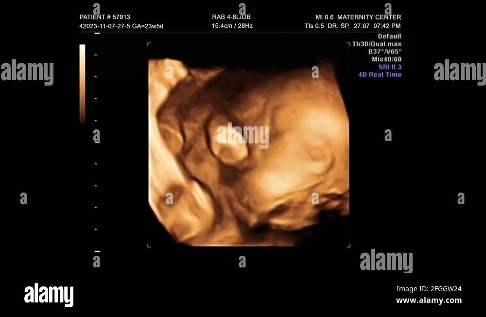 3d ultrasound baby Stock Videos & Footage - HD and 4K Video Clips - Alamy