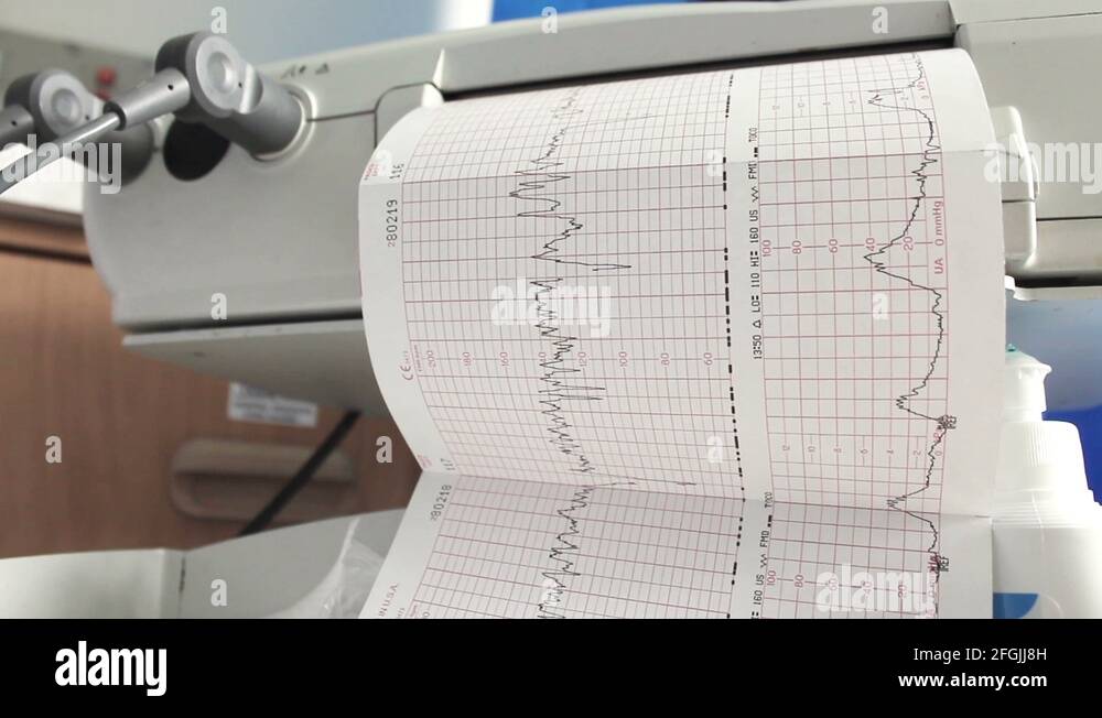 Nhs heart monitor Stock Videos & Footage - HD and 4K Video Clips - Alamy