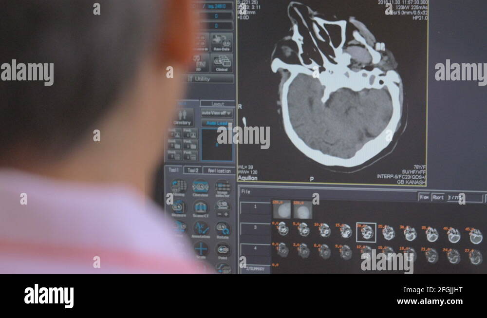 Head mri scan Stock Videos & Footage - HD and 4K Video Clips - Alamy