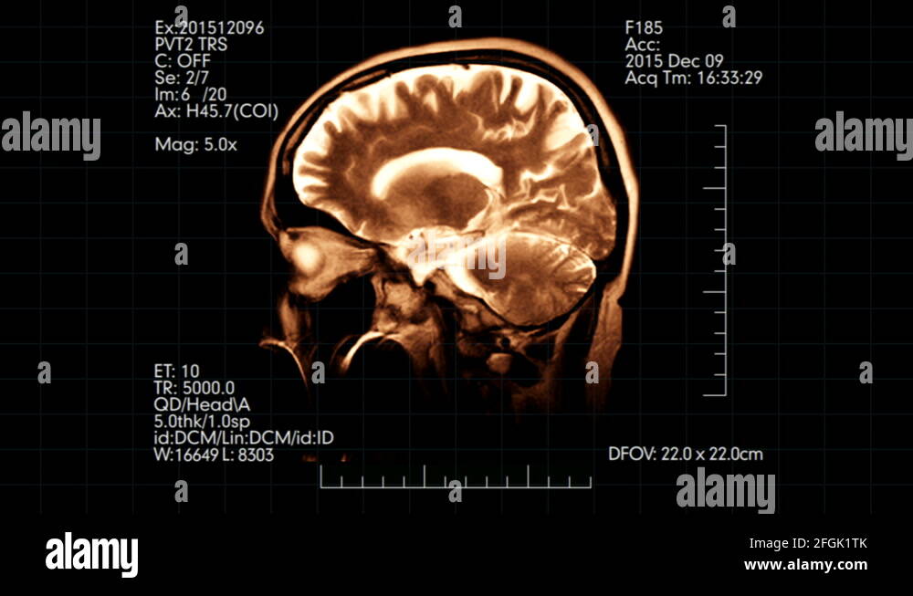 Mri scan brain color Stock Videos & Footage - HD and 4K Video Clips - Alamy