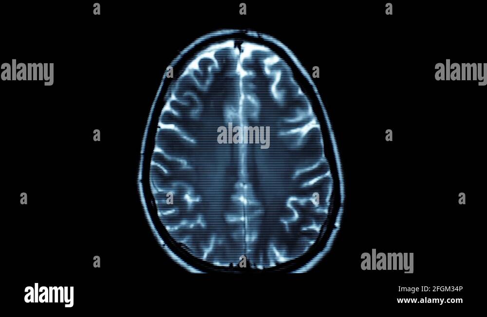 Mri of human brain Stock Videos & Footage - HD and 4K Video Clips - Alamy