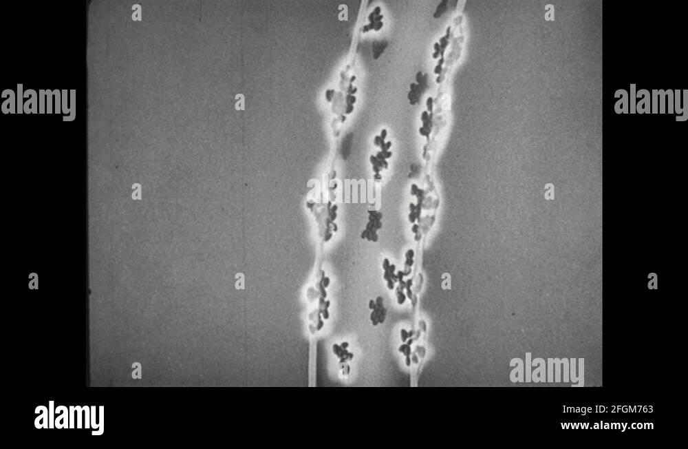 1940s: Animation of germs multiplying in urethra / silhouette of man ...