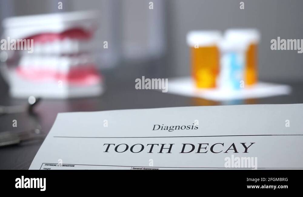 Dental caries decay rotten Stock Videos & Footage - HD and 4K Video ...