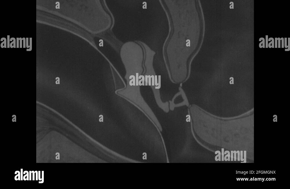 Bone diagram Stock Videos & Footage - HD and 4K Video Clips - Alamy