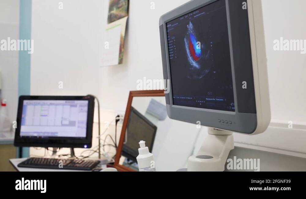 Ultrasound system with an image of human organ at display in hospital ...
