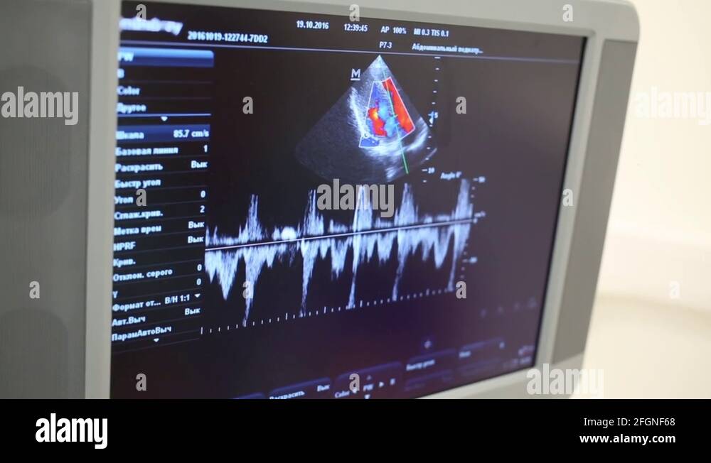 Ultrasound system Stock Videos & Footage - HD and 4K Video Clips - Alamy
