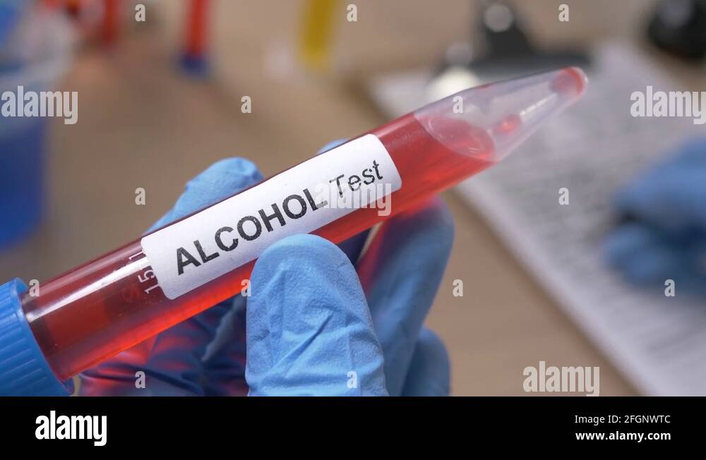 Haemoglobin disease Stock Videos & Footage - HD and 4K Video Clips - Alamy