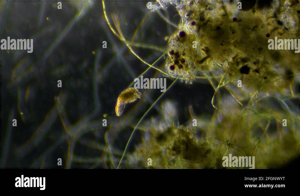Rotifer Microorganism Seen Moving With Stretch Motion Microscope 400x ...