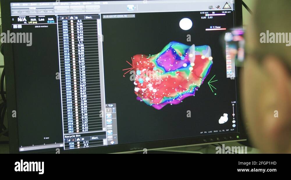 Pacemaker monitoring Stock Videos & Footage - HD and 4K Video Clips - Alamy