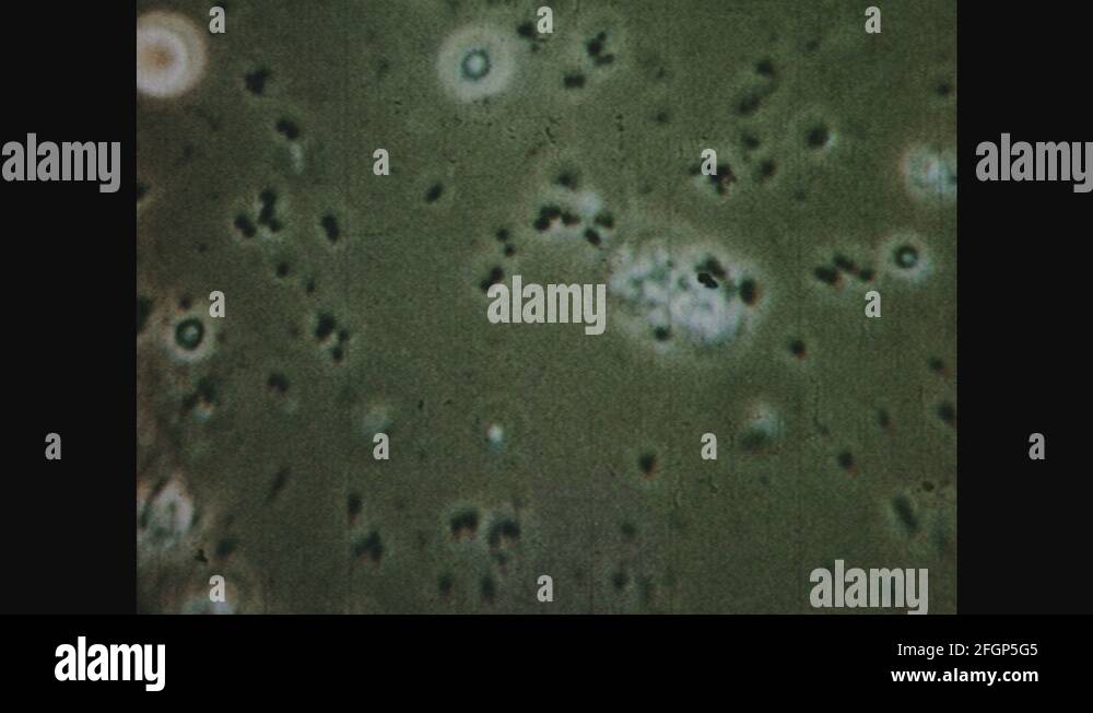 Cells microscope colour Stock Videos & Footage - HD and 4K Video Clips ...