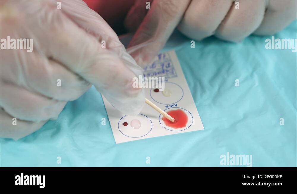 Blood panel Stock Videos & Footage - HD and 4K Video Clips - Alamy