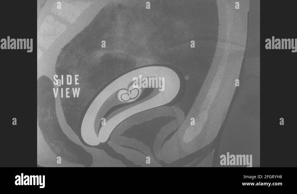 1950s: Illustration of female reproductive organ in side view ...