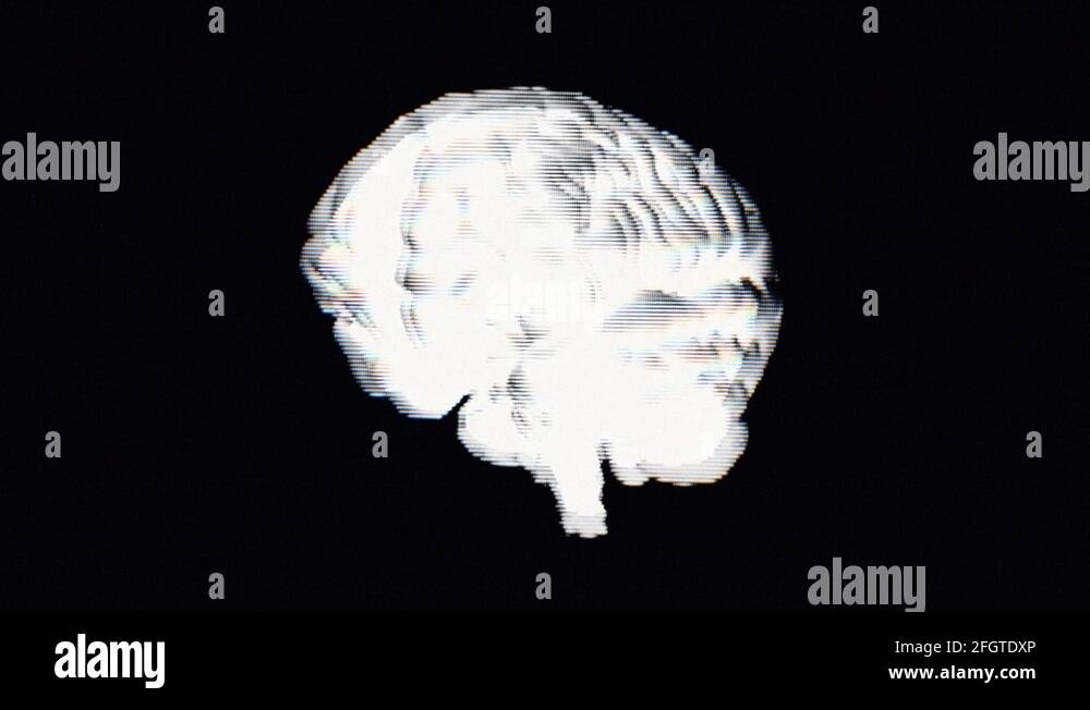 Hazard sign and brain Stock Videos & Footage - HD and 4K Video Clips ...