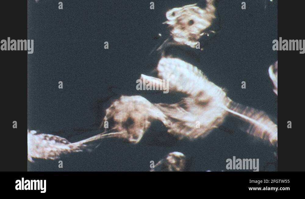 1940s: UNITED STATES: microscopic view of algae. Copepods under ...