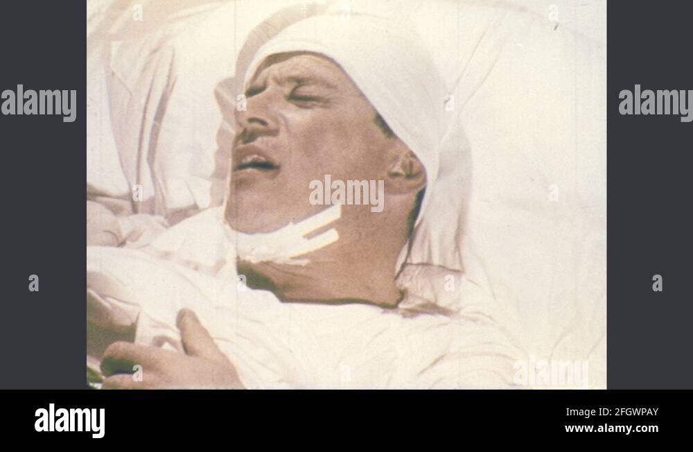 1960s: Man with bandaged face talks, closes eyes, looks to the side ...