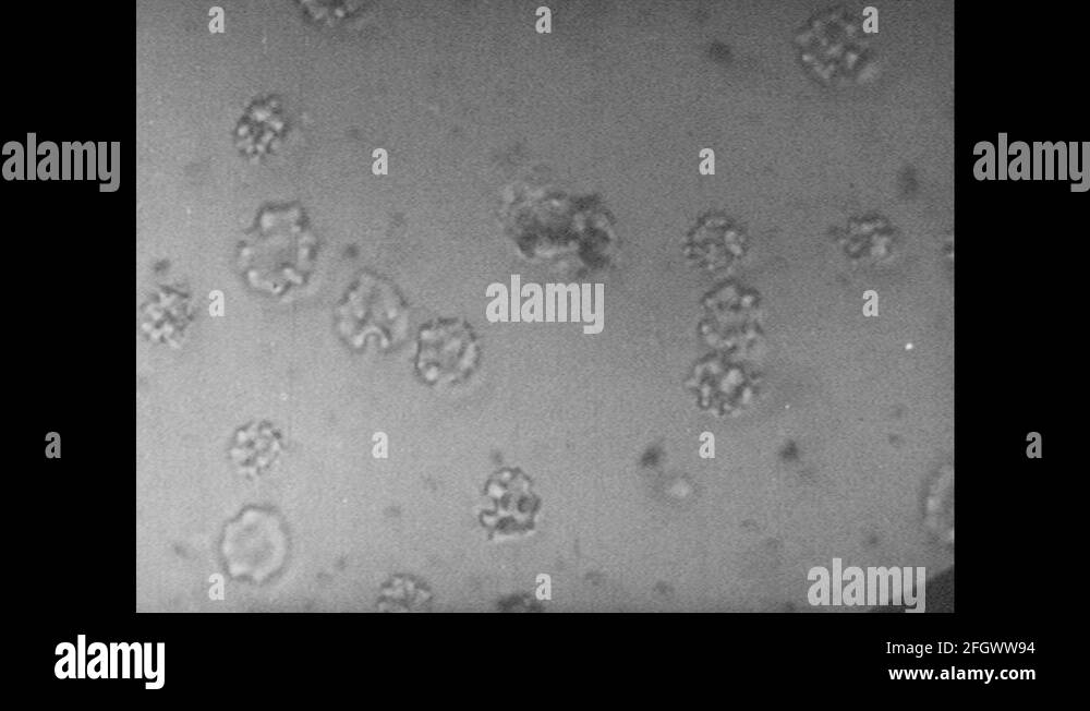 1950s: UNITED STATES: diagram of cut in skin. Bacteria engulfed by ...