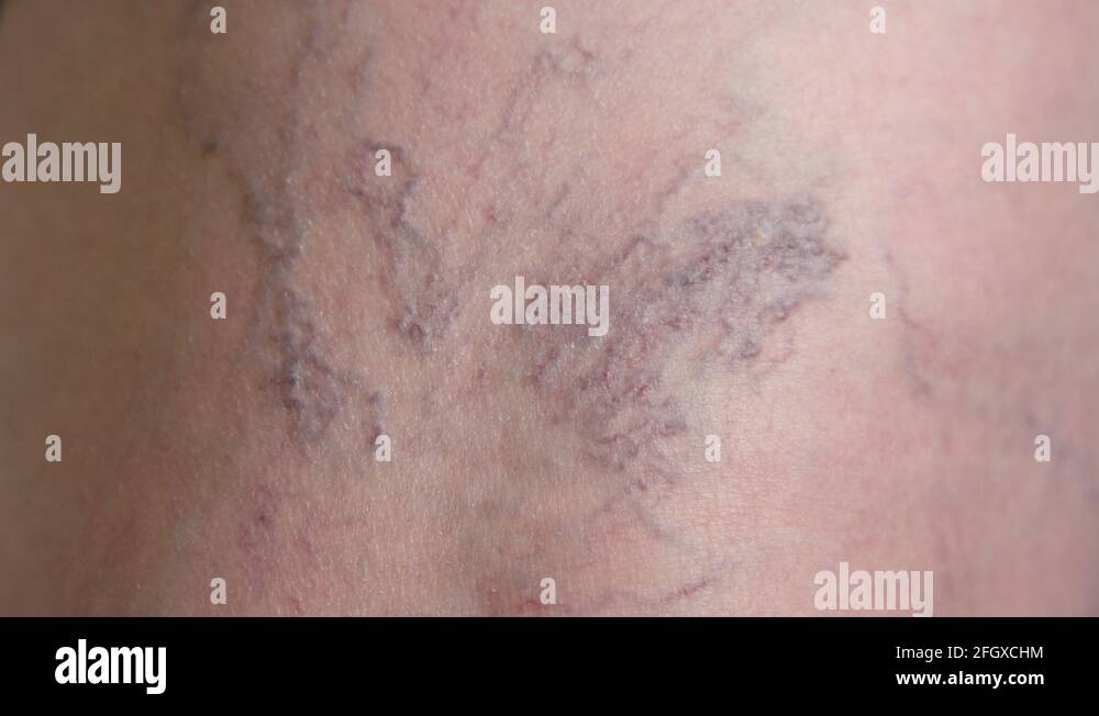 Dermal cells Stock Videos & Footage - HD and 4K Video Clips - Alamy