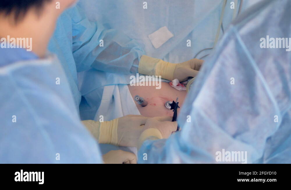 Doctor hands surgery above Stock Videos & Footage - HD and 4K Video ...