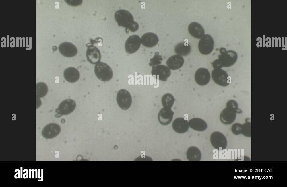 1940s: Under microscope, hatched tapeworm embryos (coracidia) swim ...