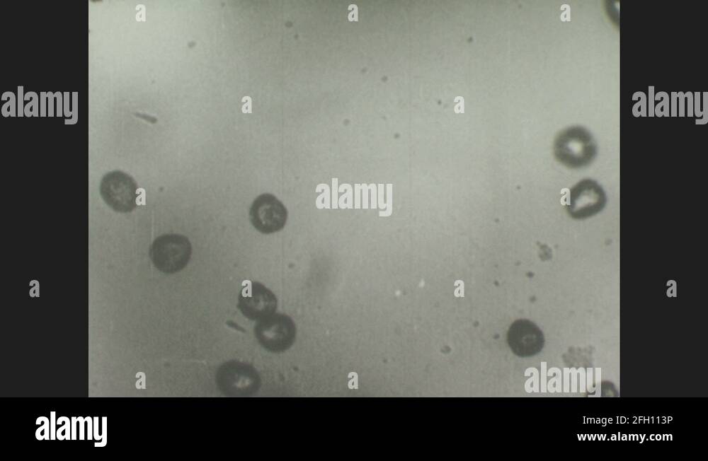 Tapeworm microscope Stock Videos & Footage - HD and 4K Video Clips - Alamy