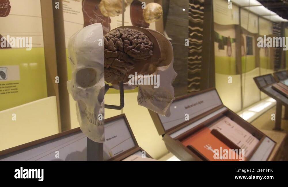 Open Skull With Brain In Museum Exposition - Slide - Left To Right ...